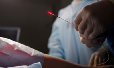 The Power of The New ACE Thulium Fiber Laser and Surgical Fiber Assemblies from Coherent